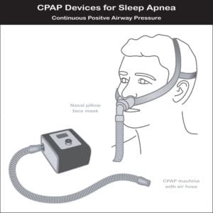What is a CPAP Machine? – A quick overview of what you need to know